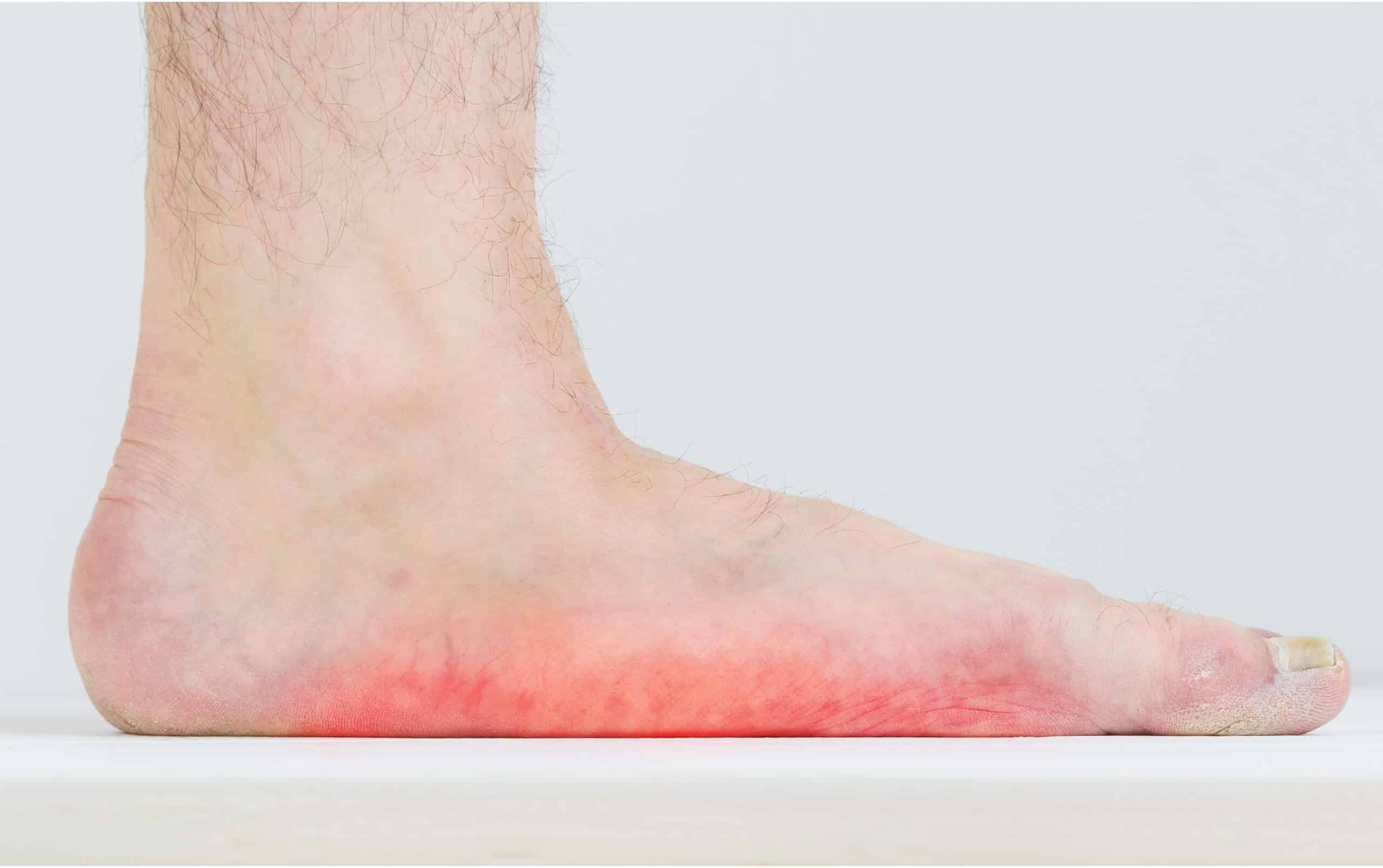 Düz Tabanlık ve İçe Basma - Op. Dr. Selim Muğrabi